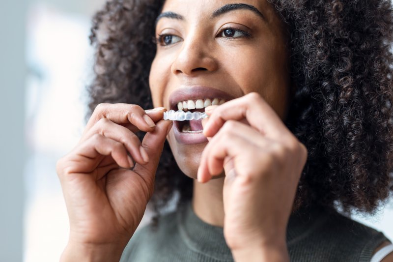 Invisalign on Only Top Teeth? Uncommon But Definitely Possible ...
